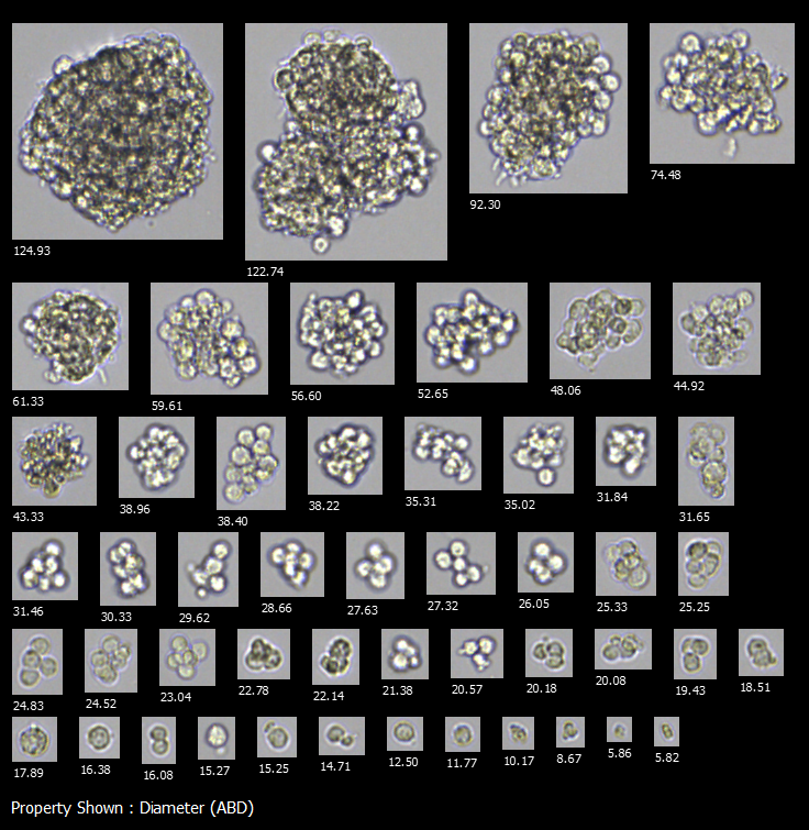 Automate Organoid Imaging with FlowCam for Disease Modeling