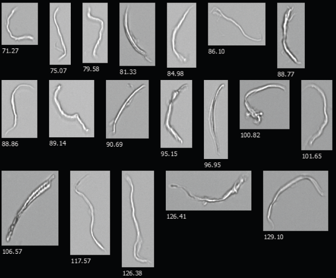 Polymer Characterization | Fiber Characterization | FlowCam