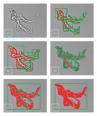 What is Flow Imaging Microscopy?