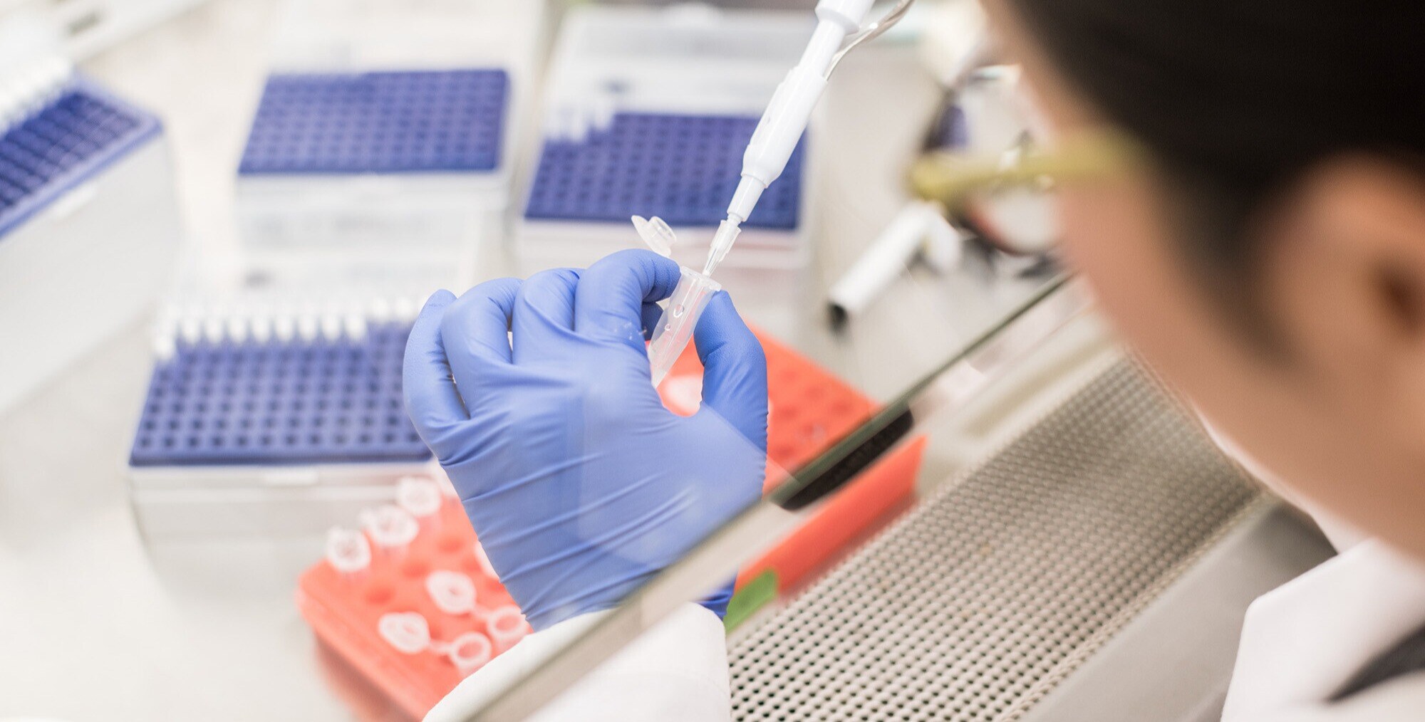 Flow Imaging Microscopy | Particle Analysis | FlowCam